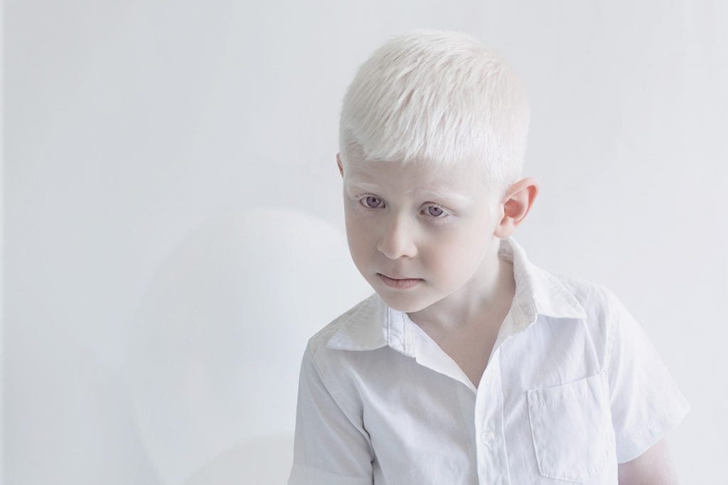 L'étrange beauté porcelaine des albinos par Yulia Taits - 2Tout2Rien